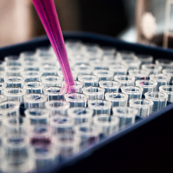 What are Batch Manufacturing Records? What are Batch Manufacturing Records?